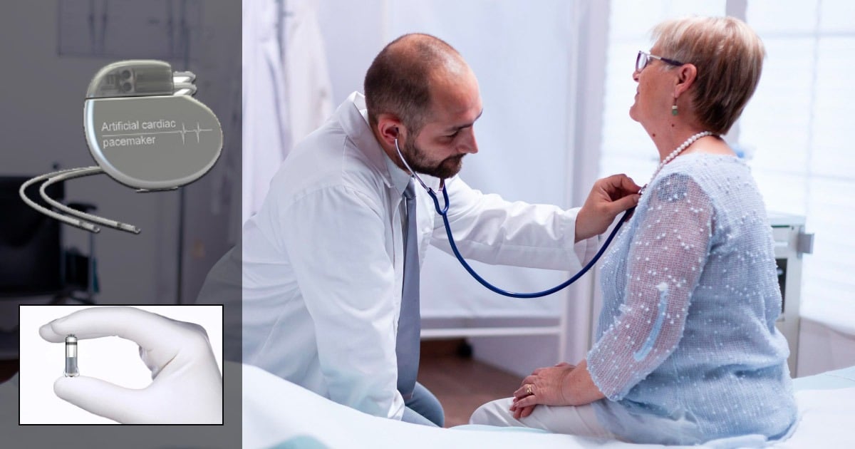 MICRA, el minimarcapasos que no requiere cirugías para su implantación ...